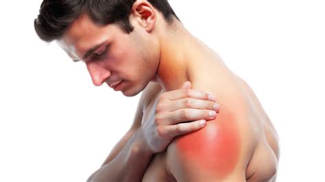 Calcific Tendinitis Causes Symptoms And Treatment Options Freedom