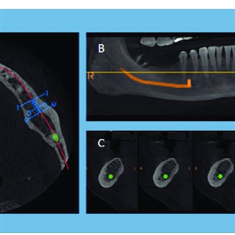 Pdf Cone Beam Computed Tomography Basics And Applications In Dentistry