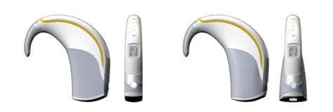 Cochlear Implant Speech Processor 2003 2005 By Peter Sprada At