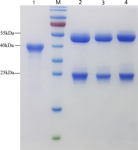 Protein Electrophoresis Gel Explained At Lilian Knopwood Blog