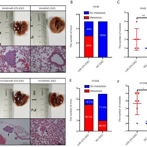 Exosomal Mir 375 3p Promoted Sclc Metastasis In Mice A The