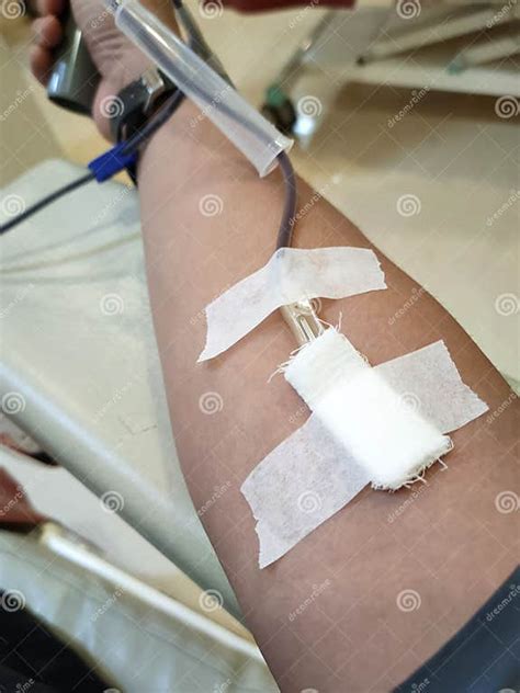 O Processo De Transfusão De Sangue Ou De Doação De Sangue Foto De Stock Imagem De Doador