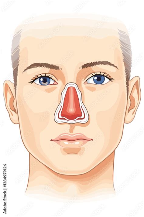 Vibrant Vector Illustration Of A Deviated Nasal Septum In A Human Face Showing Cross Section