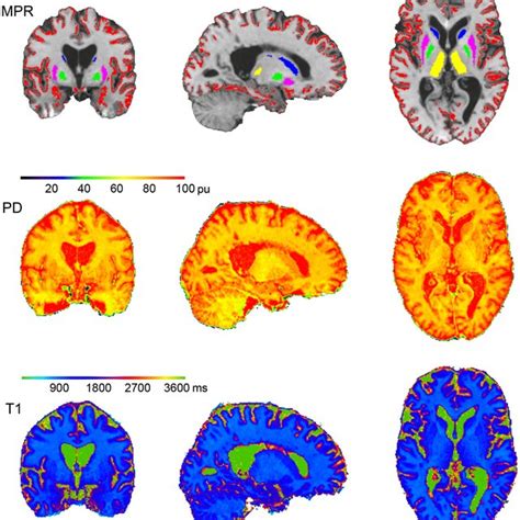Representative Example For Calculated Quantitative Maps And
