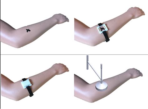Figure 3 From A New 3d Printed Applicator With Radioactive Gel For