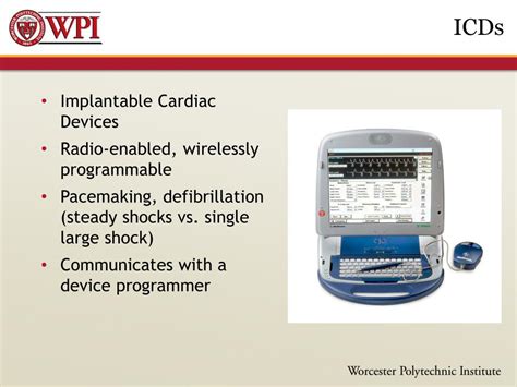 Ppt Pacemakers And Implantable Cardiac Defibrillators Software Radio
