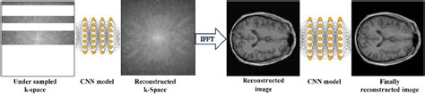 Proposed Mri Reconstruction Method Download Scientific Diagram