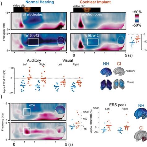 neural oscillation analysis a eeg event related synchronization and