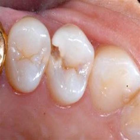 Icdas 1889 Object Detection Model By Hibogiaiunjani