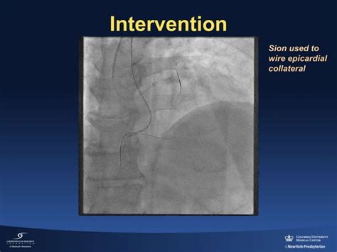 Proximal Ambiguity Impenetrable Cap Ppt