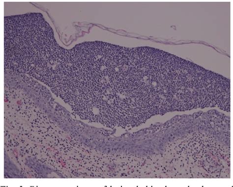 Figure 1 From Subcorneal Pustular Dermatosis In A Dog Semantic Scholar