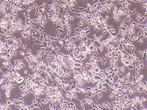 Mc38细胞系 小鼠结肠癌细胞 逸漠细胞库