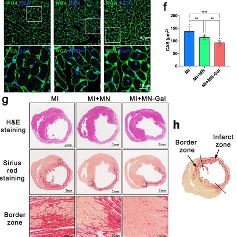 Mn Gal Patch Decreased Infarct Scar Extension And Expansion And