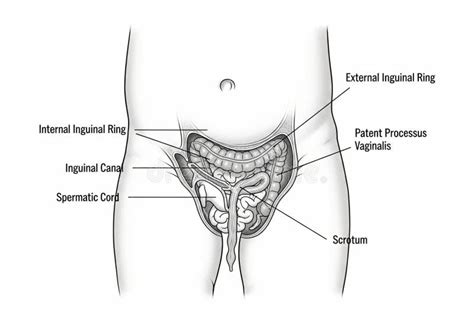 Medical Illustration Showing The Anatomy Of The Male Inguinal Stock