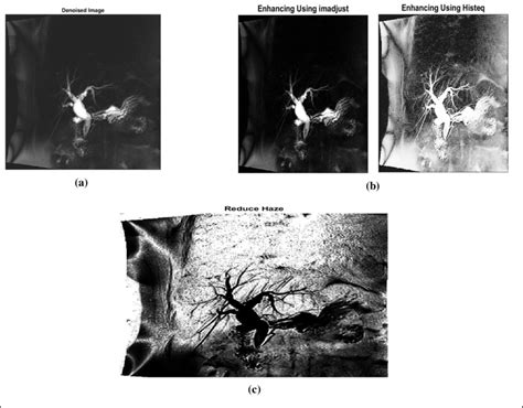 Pre Processing Techniques A De Noised Image Using Dncnn B Image