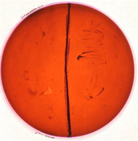 Ciencias Jpl Cultivo Bacteriano