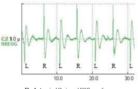 figure 1 from robotic control by eog eeg rfid based multimodal