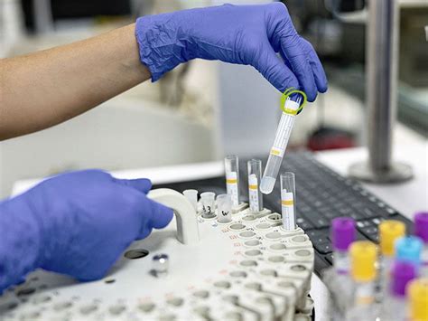 Hiv Rna Nanomedicine Reduces Disease Replication By 73 Medical News Today