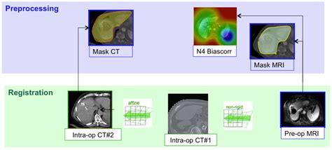 Non Rigid Mr Ct Image Registration Namic Wiki