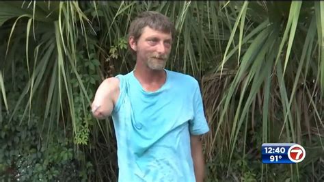 Florida Man Who Lost Arm In Alligator Attack Speaks Out Wsvn 7news