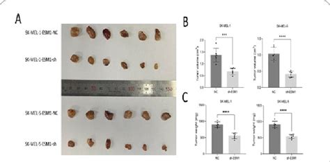 Esm1 Promotes Tumorigenesis In Mice A B C Xenograft Weight Mg