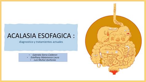 Acalasia Esofágica Piechtwo Udocz