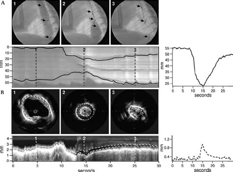Construction And Analysis Of Spatiotemporal Maps A Representative Download Scientific