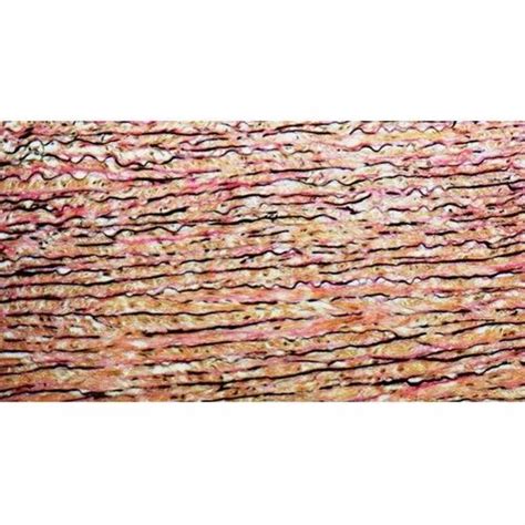 Elastic Stain Kit At Best Price In Hyderabad Id 23136500862 Elastic Stain Kit At Best Price In Hyderabad Id 23136500862
