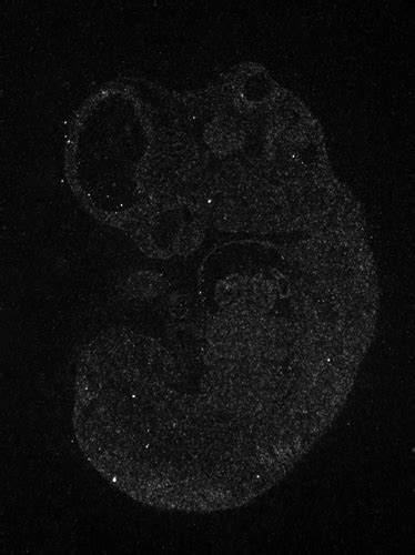 Gfap Rna In Situ Gene Expression Assay Gxd