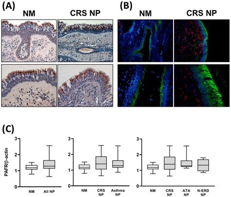 Paf Receptor Pafr Protein Expression In Nasal Mucosa Nm And Nasal Download Scientific
