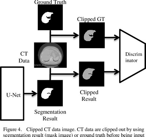 Figure 4 From Automatic Liver Segmentation Using U Net With Wasserstein