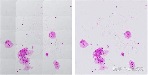 基于全卷积神经网络的显微图像光照不均校正 知乎