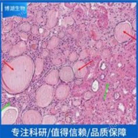 人卵巢上皮细胞 培养基图片 环保在线