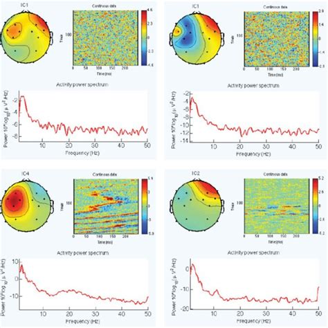Pdf Automatic Artifact Suppression In Simultaneous Tdcs Eeg Using