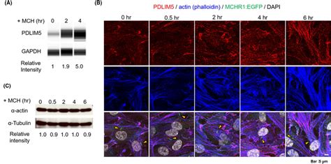 Dynamics Of Pdlim5 Protein And Actin Polymerization Are Associated With