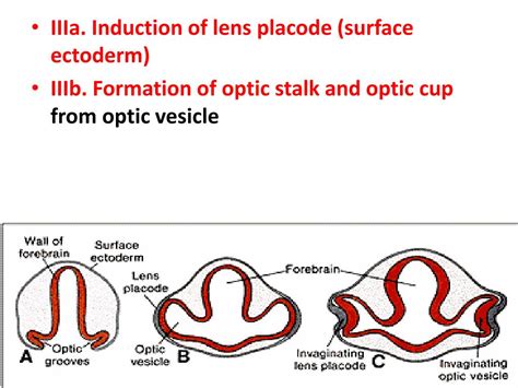 Lens Placode Embryology Pathology Ento Key A Thickened Portion Of