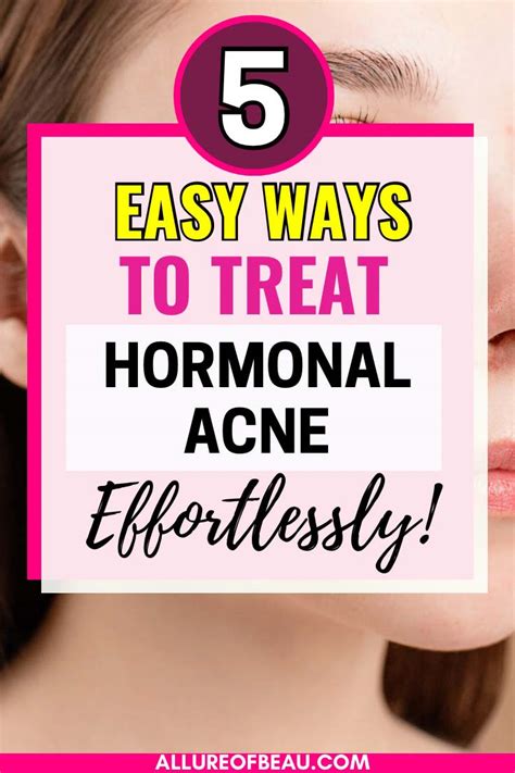 How To Get Rid Cheek Acne ALLURE OF BEAU