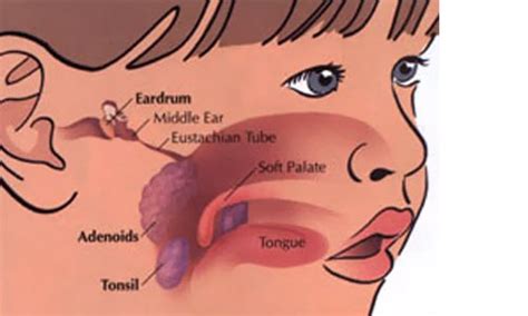 Трета сливица какво е общото между ортодонт и УНГ специалист Orthos Dent Care