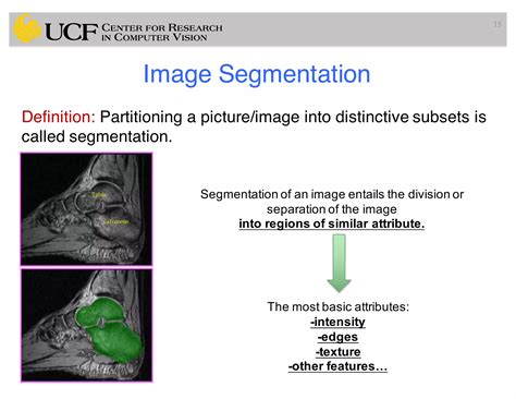 lec7 medical image segmentation i radiology applications of