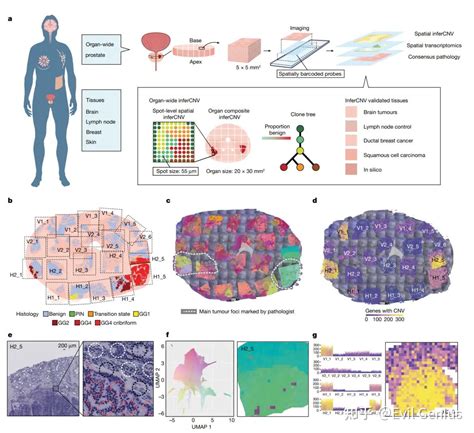 利用空间转录组学揭示良性和恶性组织中的细胞拷贝数变异 知乎