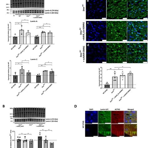 Levels And Distribution Of Smn In Heart Tissues From Smn 2b− Mice