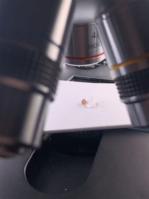 Jumping Spider Head Cap Through My Microscope R Spiderbro