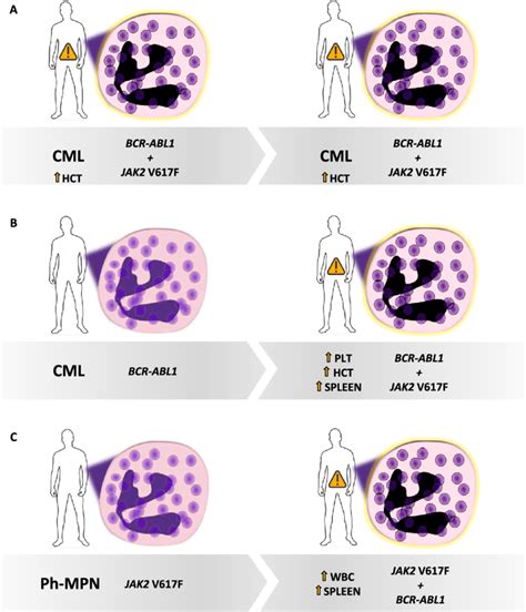 Different Possible Scenarios Of Bcr Abl1 And Jak2 V617f Co Occurrence Download Scientific