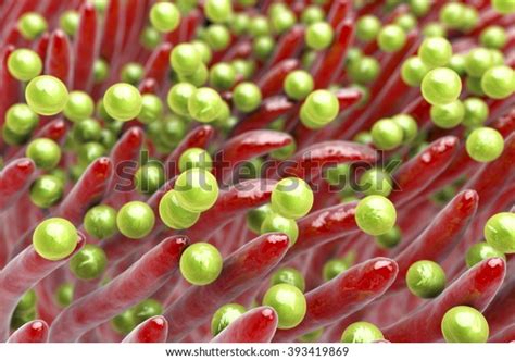 Mrsa Nose Infection Over 96 Royalty Free Licensable Stock Illustrations And Drawings Shutterstock