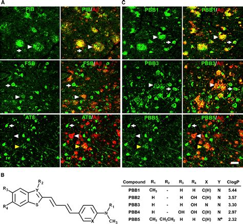 Figure 1 From Imaging Of Tau Pathology In A Tauopathy Mouse Model And