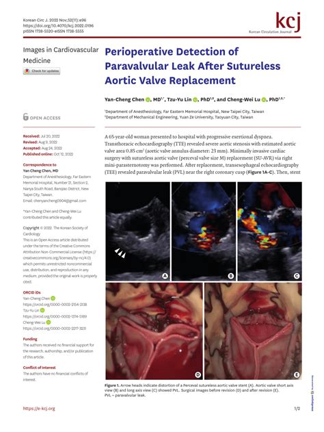 Pdf Perioperative Detection Of Paravalvular Leak After Sutureless Aortic Valve Replacement