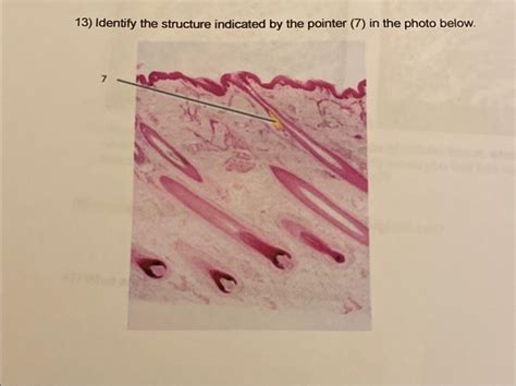 Solved Identify The Structure Indicated By The Pointer Chegg