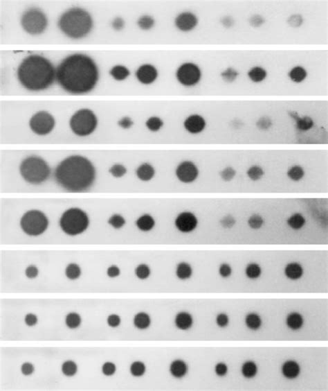 Dot Blotting Of Cdnas Cloned From Human Immunoblast Lymphoma After Download Scientific Diagram