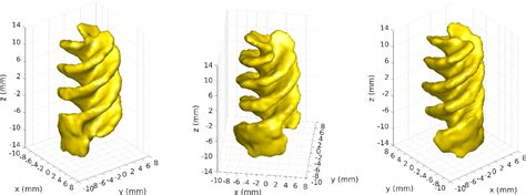 Figure 21 From Electron Paramagnetic Resonance Image Reconstruction With Total Variation Figure 21 From Electron Paramagnetic Resonance Image Reconstruction With Total Variation
