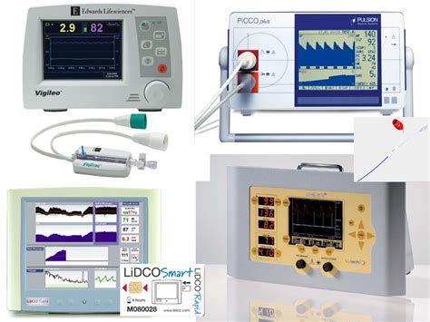 Minimally Invasive Cardiac Output Monitoring In The Year 2012 Intechopen